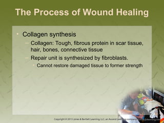Soft Tissue Trauma for Pre-Hospital Provider | PPT