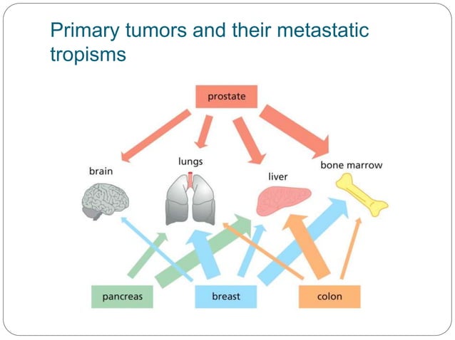 Chapter 32 invasion and metastasis | PPTX | Cancer | Diseases and ...