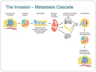 Chapter 32 invasion and metastasis | PPTX