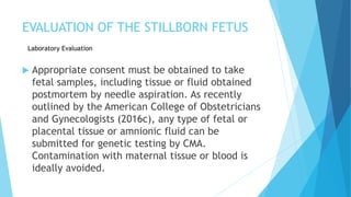 stillbirth based on Williams Obstetrics, 25th Edition,2019 | PPT