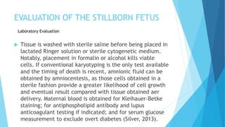 stillbirth based on Williams Obstetrics, 25th Edition,2019 | PPT