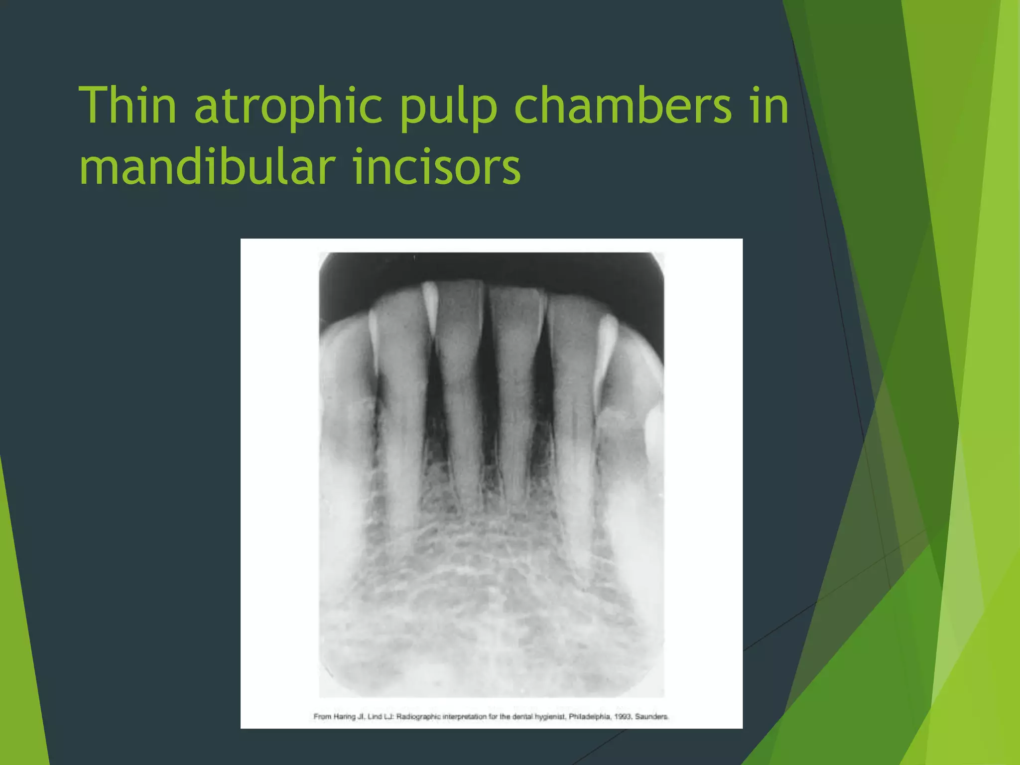 Chapter 35: Interpretation of Trauma, Pulpal Lesions, and Periapical ...