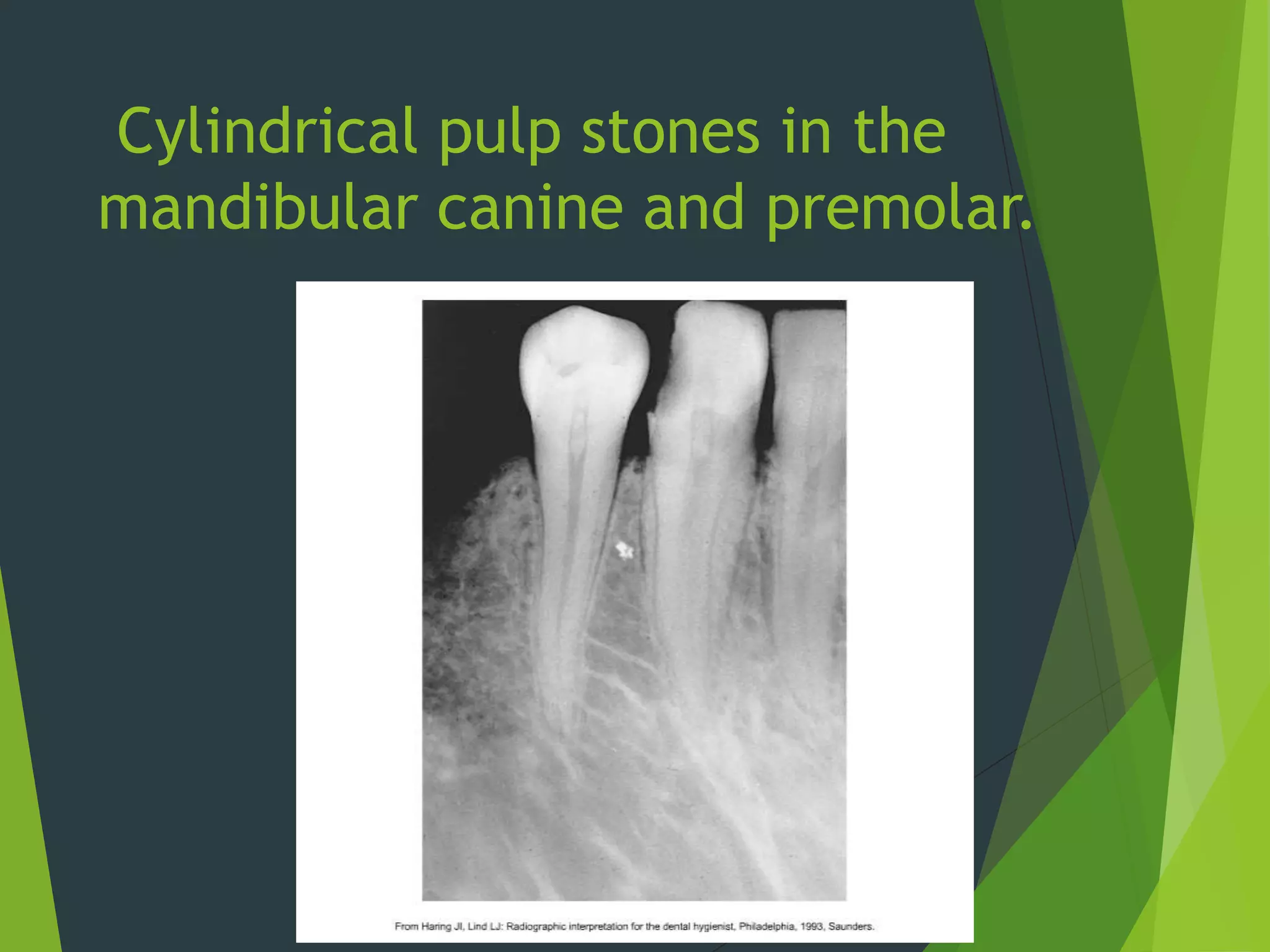 Chapter 35: Interpretation of Trauma, Pulpal Lesions, and Periapical ...