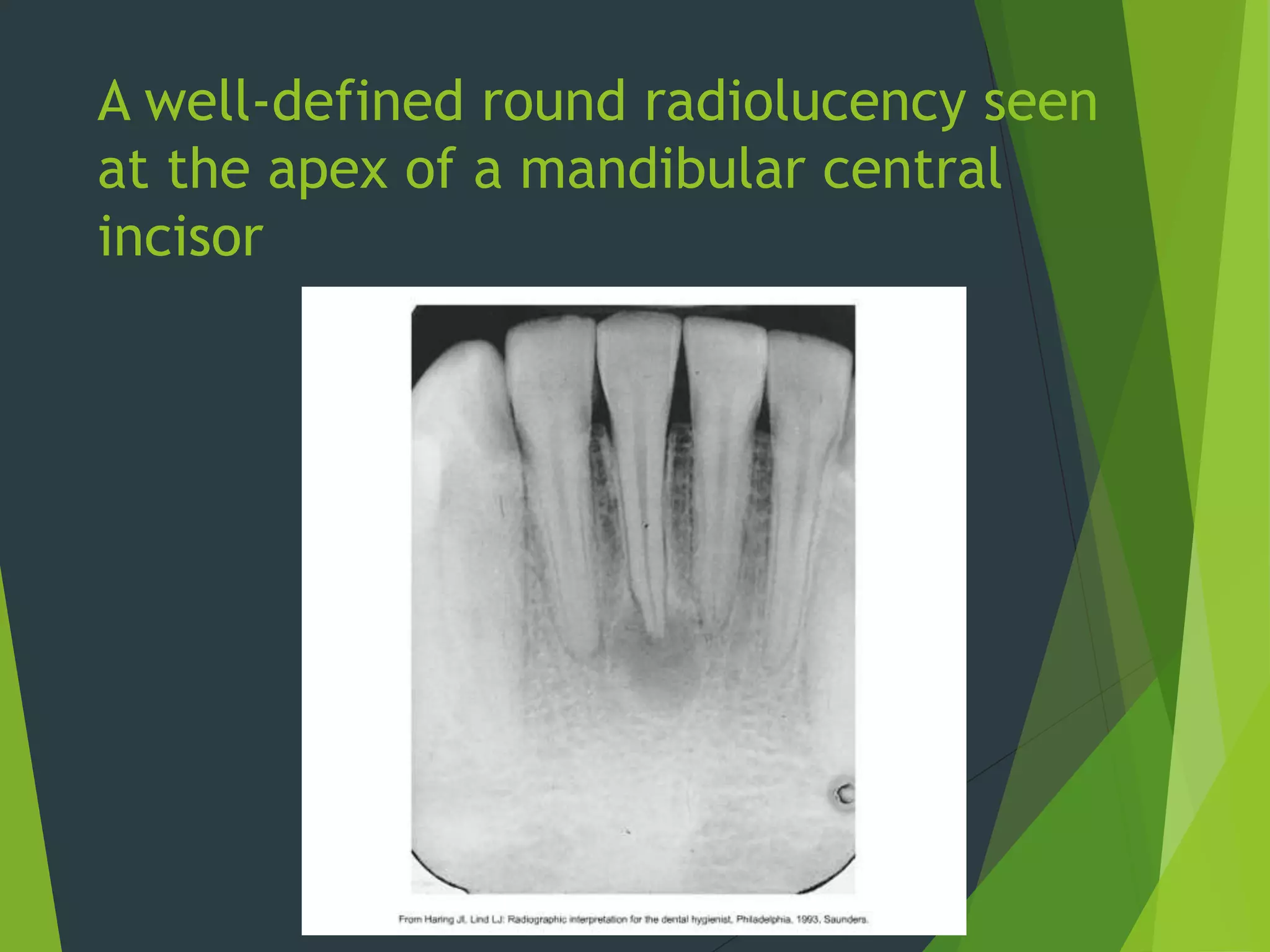 Chapter 35: Interpretation of Trauma, Pulpal Lesions, and Periapical ...