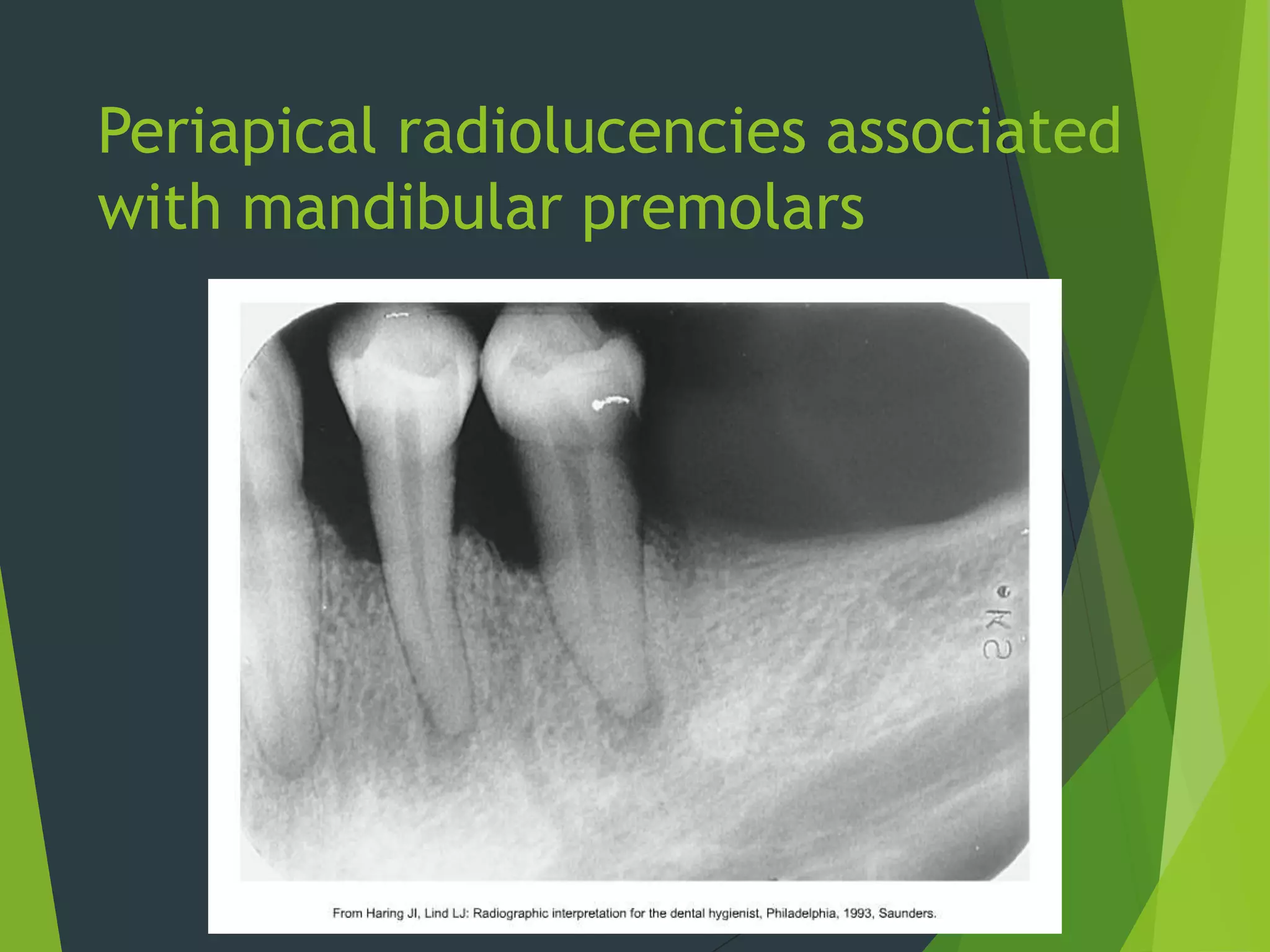 Chapter 35: Interpretation of Trauma, Pulpal Lesions, and Periapical ...