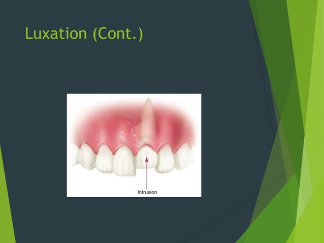 Chapter 35: Interpretation of Trauma, Pulpal Lesions, and Periapical ...