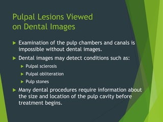 Chapter 35: Interpretation of Trauma, Pulpal Lesions, and Periapical ...