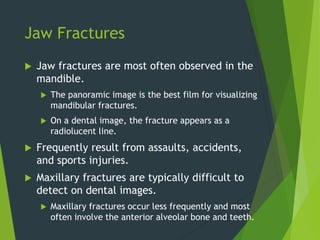 Chapter 35: Interpretation of Trauma, Pulpal Lesions, and Periapical ...