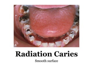 Periodontal Treatment of Medically Compromised Patients | PDF