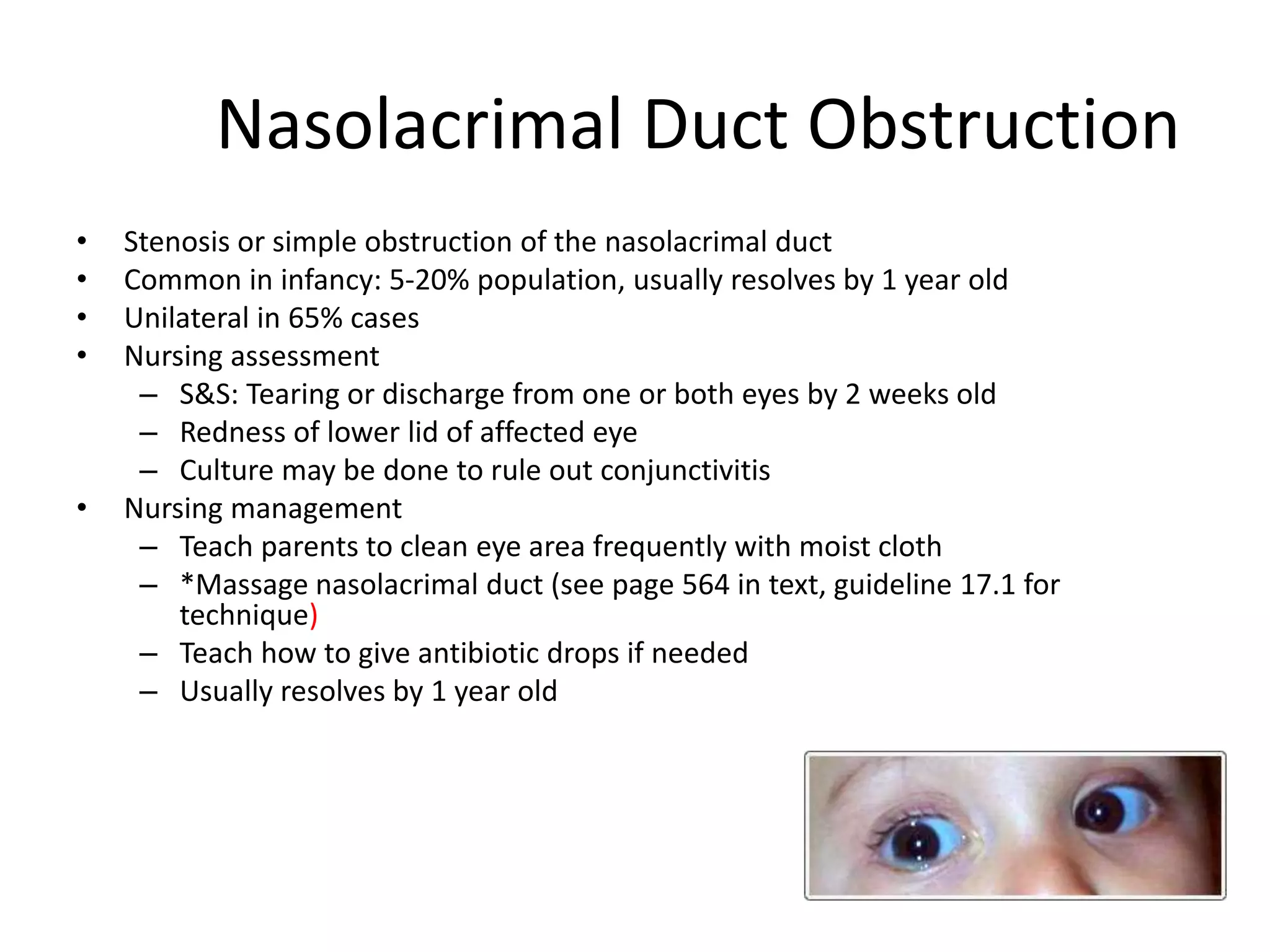 Chapter 39 Nursing Care of the Child with a Disorder of the Eyes or ...