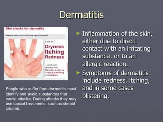 Chapter 3 presentation | PPT | Skin and Dermatology | Diseases and ...