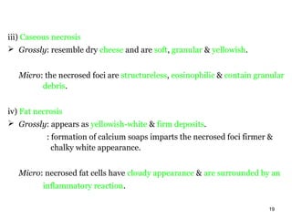 Necrosis | PPT | Digestive Disorders | Diseases and Conditions