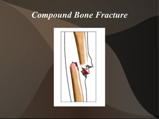 Chapter 4 presentation | PPT