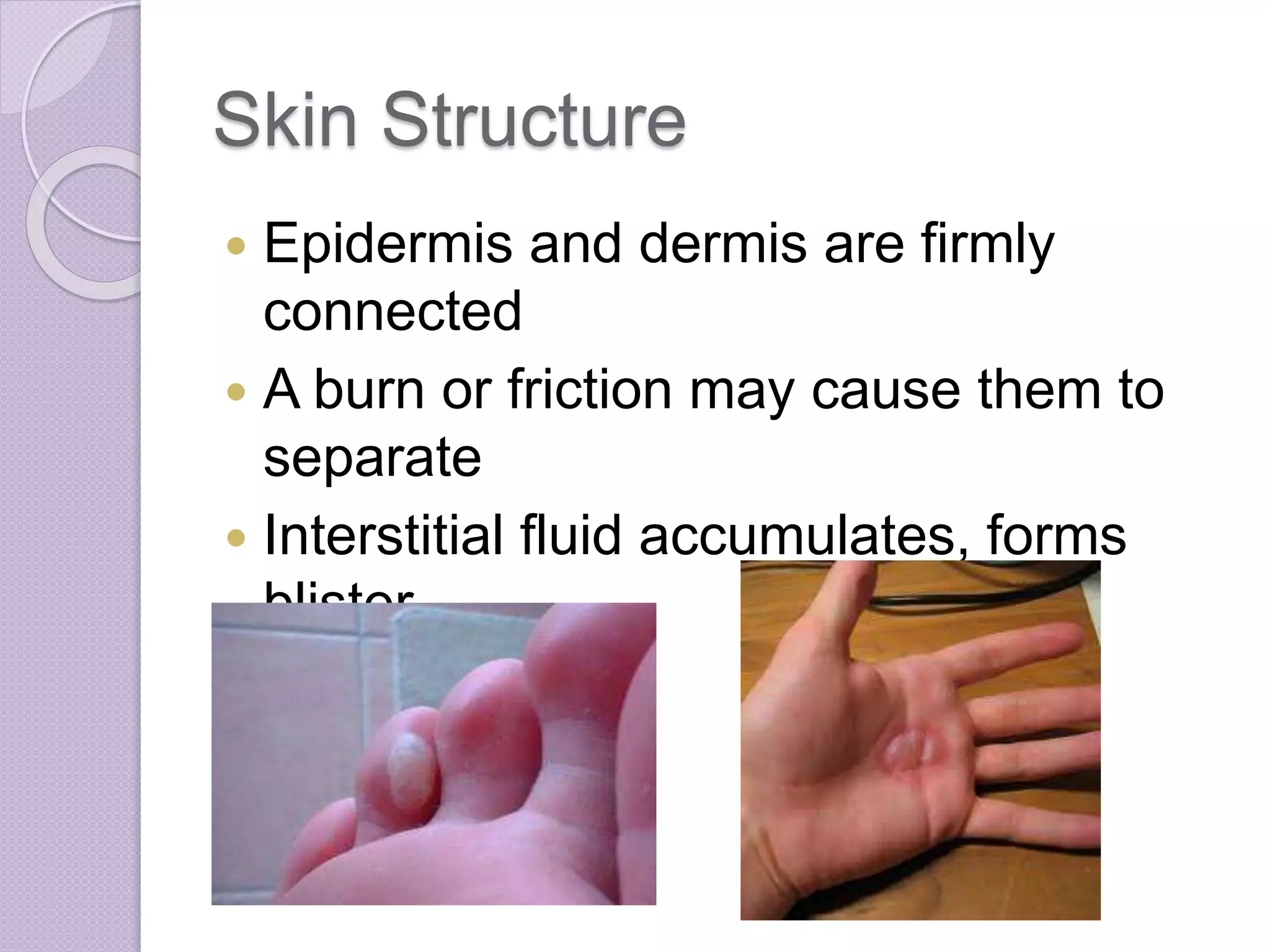 Chapter 4 - Skin and Body Membranes | PPTX