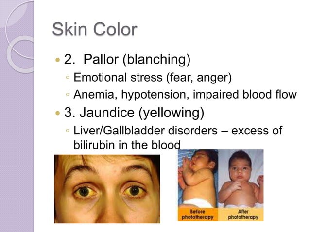 Chapter 4 - Skin and Body Membranes | PPTX | Skin and Dermatology ...