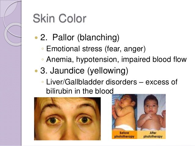 Chapter 4 - Skin and Body Membranes