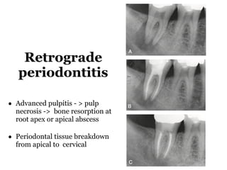 Diagnosis and Management of Endodontic-Periodontic Lesions | PDF