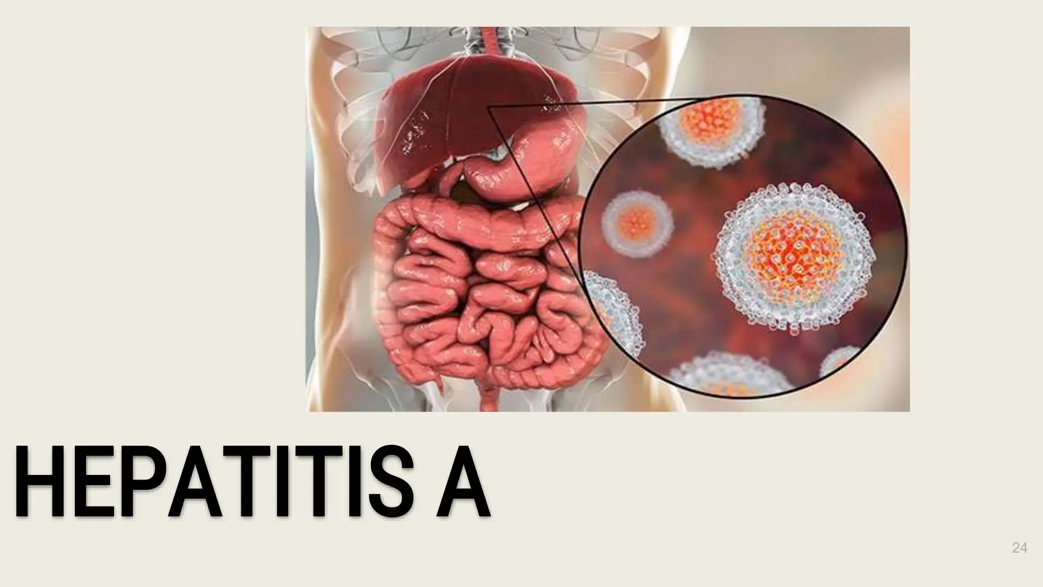 chapter 47 - Infective syndromes of hepatobiliary system dr bhavika ...