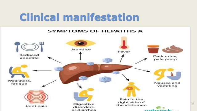 chapter 47 - Infective syndromes of hepatobiliary system dr bhavika ...