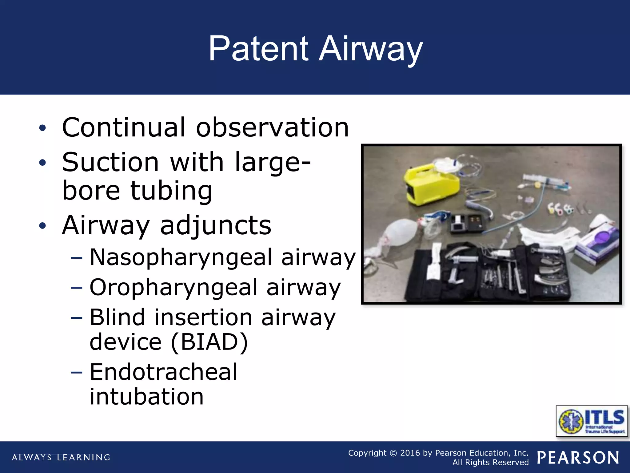 Chapter4 airway management | PPT