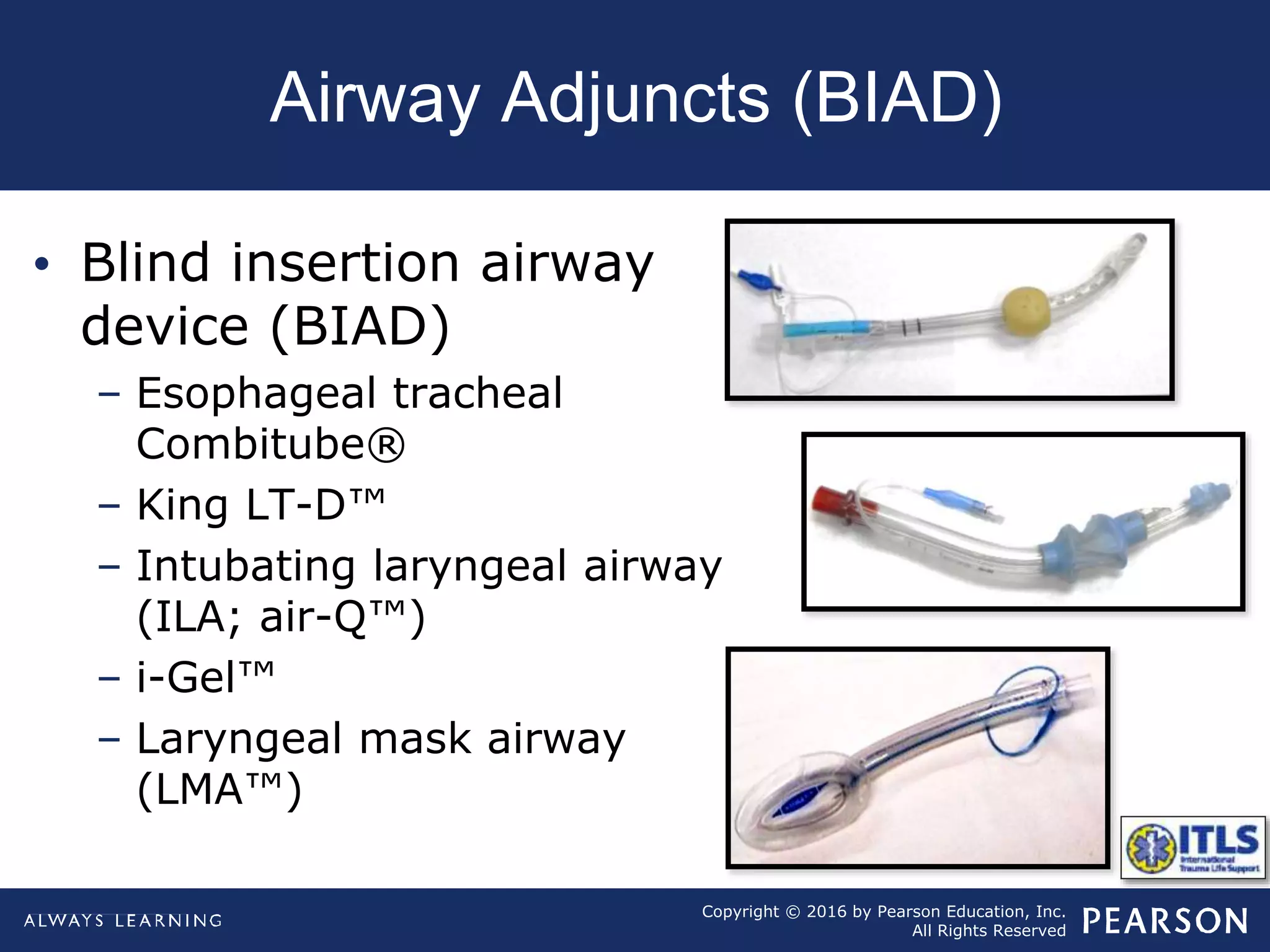 Chapter4 airway management | PPT