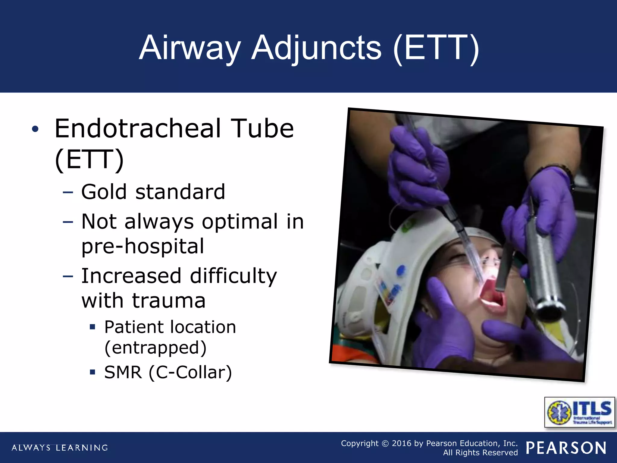 Chapter4 airway management | PPT