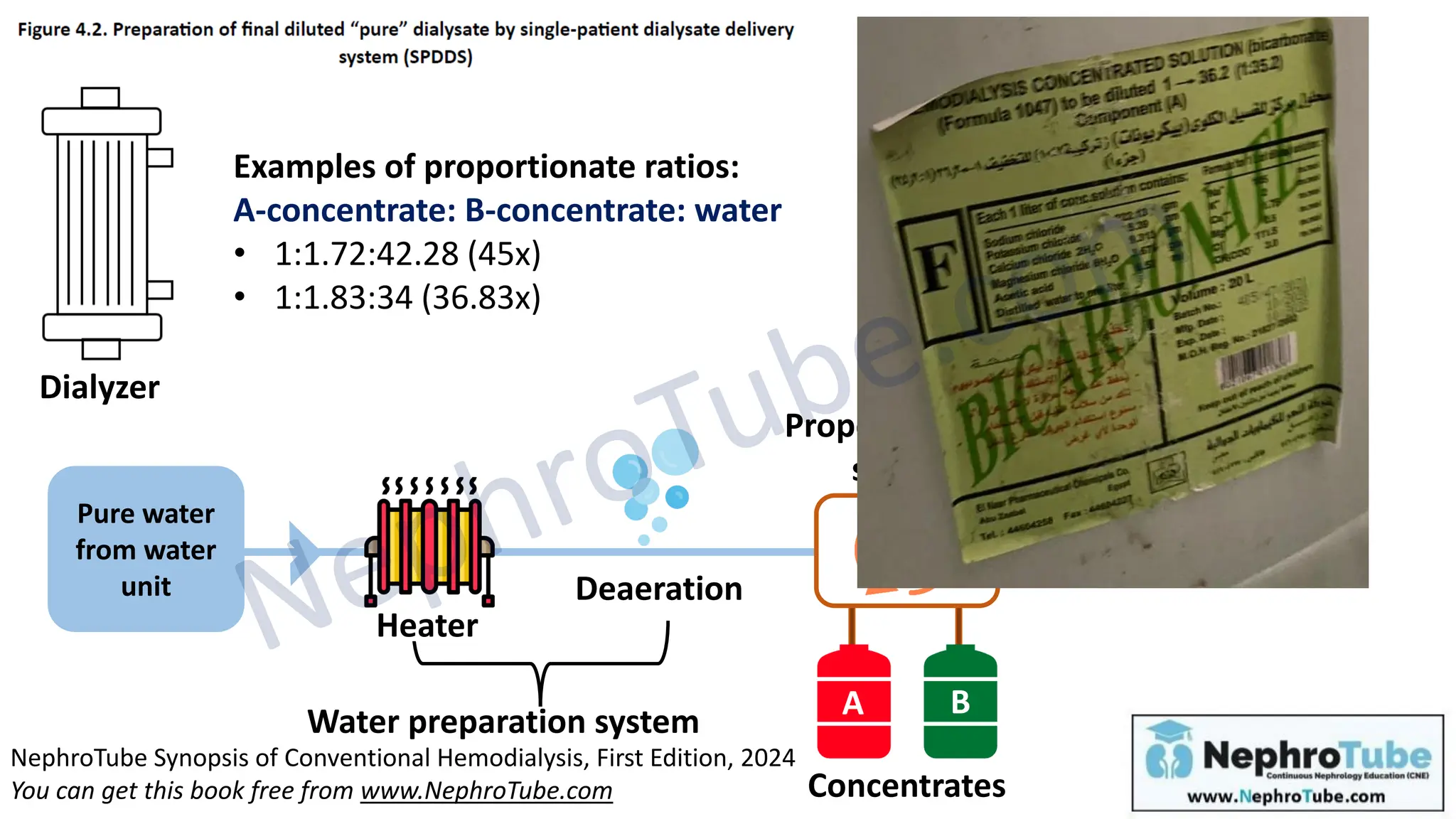 Hemodialysis: Chapter 4, Dialysate Circuit - Dr.Gawad | PDF