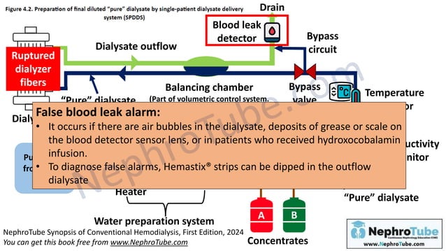 Hemodialysis: Chapter 4, Dialysate Circuit - Dr.Gawad | PDF