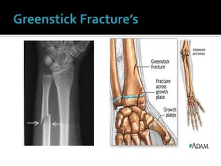 Chapter 4 Presentation | PPT