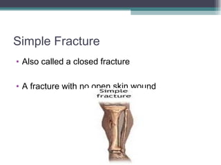 Chapter 4 ppt. | PPT