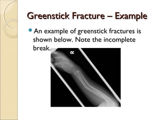 PRESENTATION 04 - Musculoskeletal System | PPT