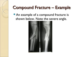 PRESENTATION 04 - Musculoskeletal System | PPT