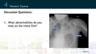 Chapter 4_ Thoracic Trauma.pptx ATLS..... | PPTX