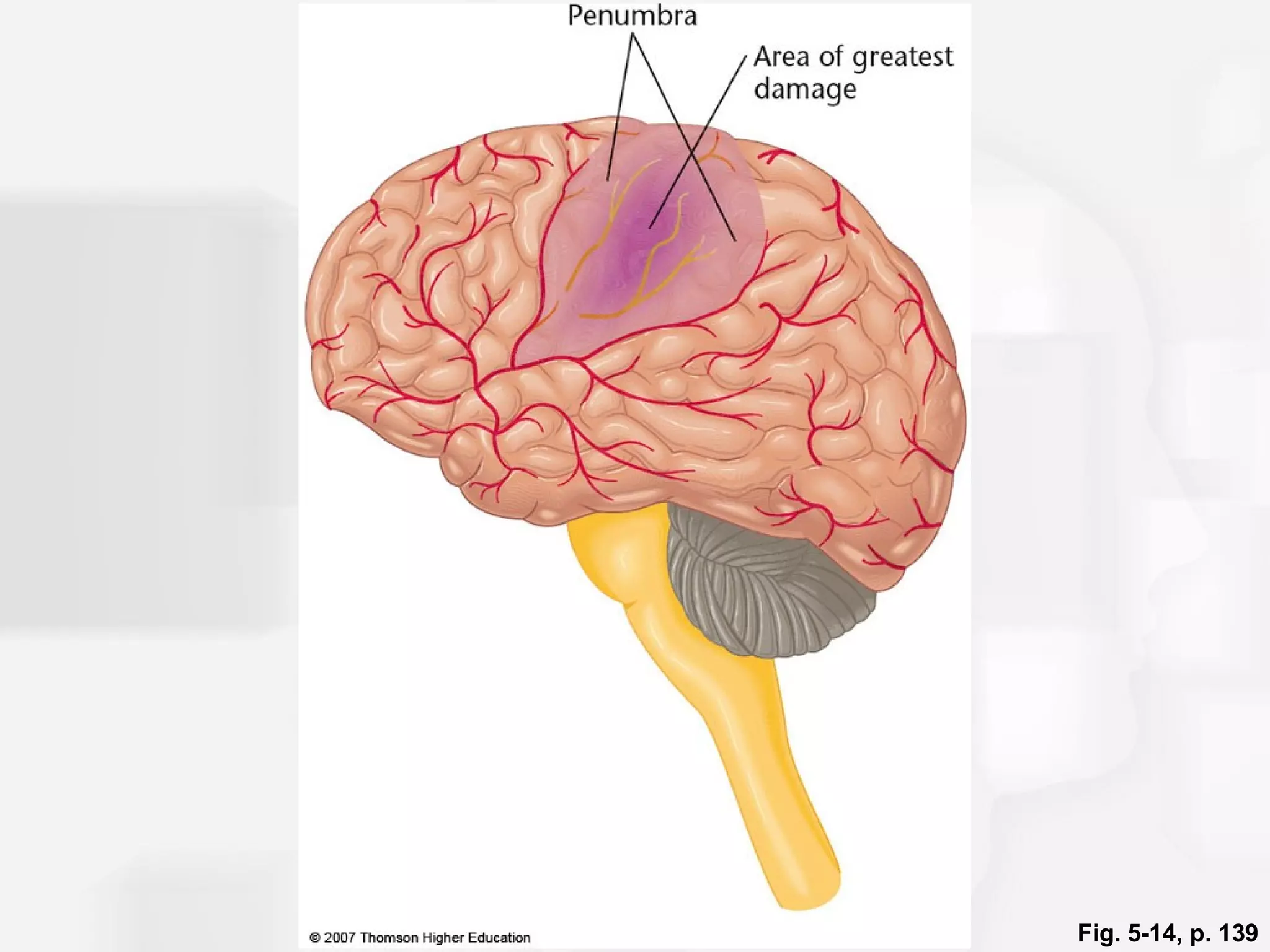 Chapter5 Power Point Lecture | PPT