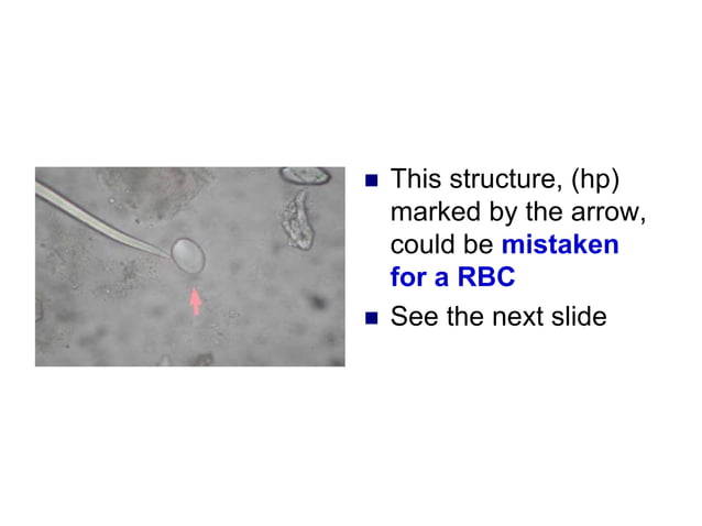 Chapter 5. Microscopic examination of urine ppt | PPT | Blood Disorders ...