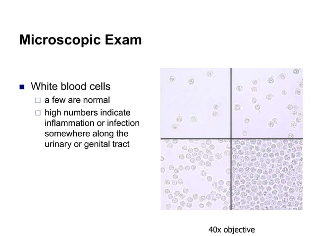 Chapter 5. Microscopic examination of urine ppt | PPT | Blood Disorders ...