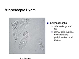 Chapter 5. Microscopic examination of urine ppt | PPT