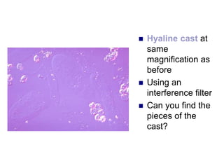 Chapter 5. Microscopic examination of urine ppt | PPT