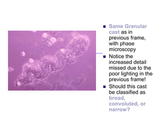 Chapter 5. Microscopic examination of urine ppt | PPT