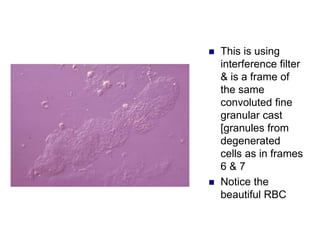 Chapter 5. Microscopic examination of urine ppt | PPT