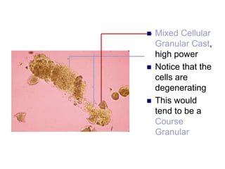 Chapter 5. Microscopic examination of urine ppt | PPT