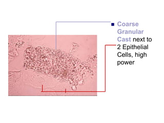 Chapter 5. Microscopic examination of urine ppt | PPT