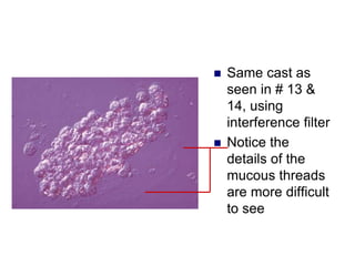 Chapter 5. Microscopic examination of urine ppt | PPT