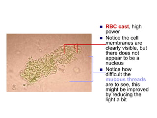 Chapter 5. Microscopic examination of urine ppt | PPT