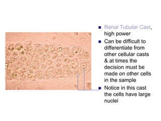 Chapter 5. Microscopic examination of urine ppt | PPT