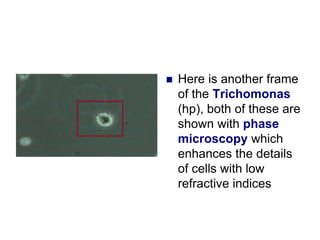 Chapter 5. Microscopic examination of urine ppt | PPT