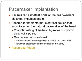 Chapter 5 - Cardiovascular System | PPTX