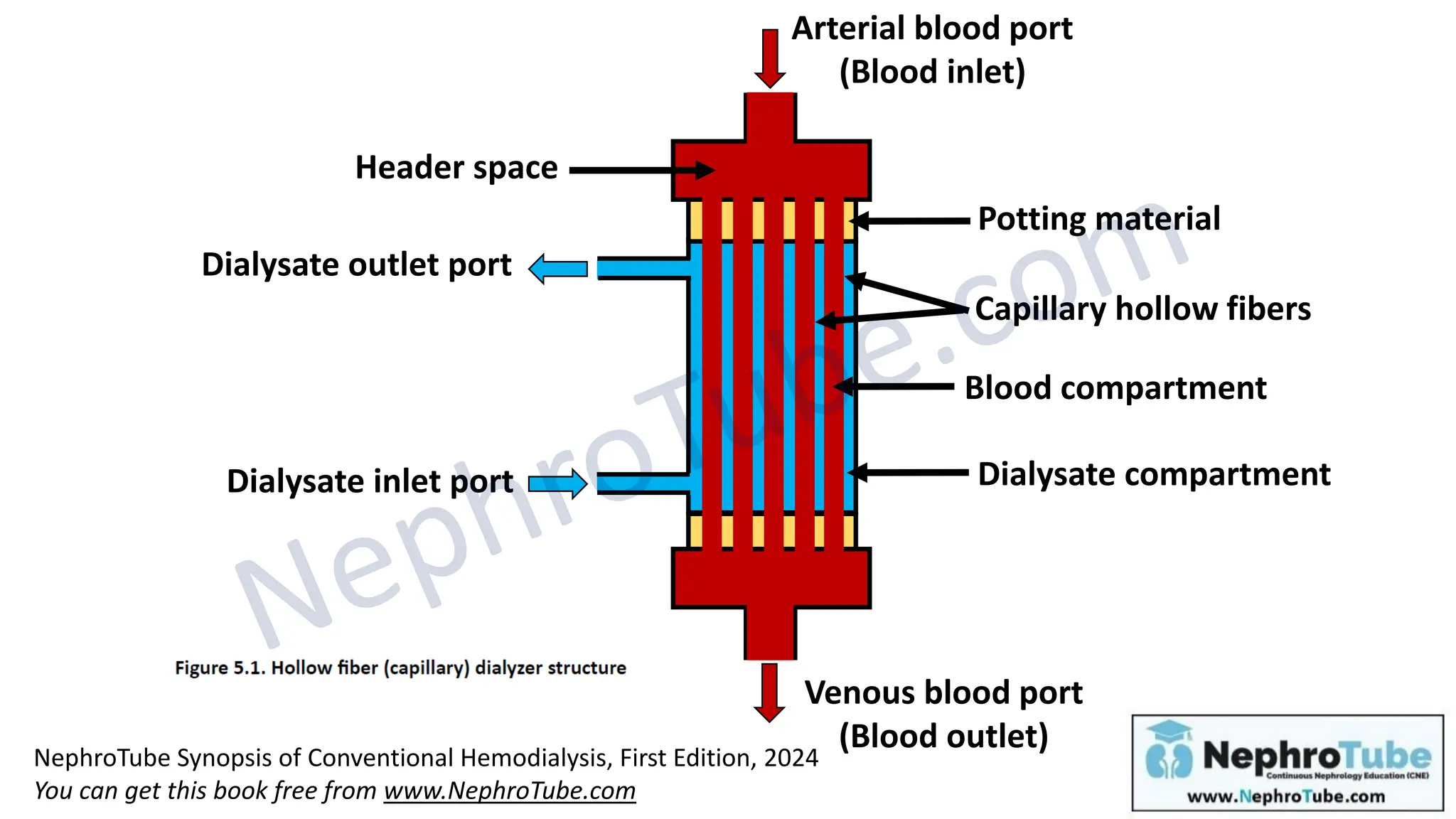 Hemodialysis: Chapter 5, Dialyzers Overview - Dr.Gawad | PDF