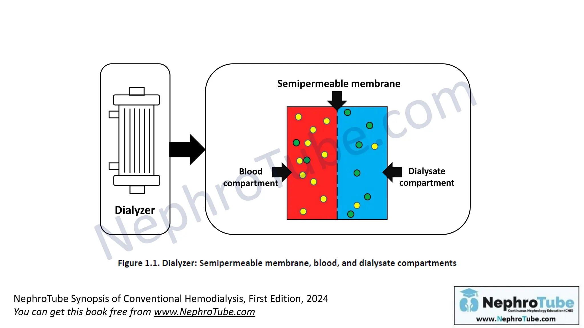 Hemodialysis: Chapter 5, Dialyzers Overview - Dr.Gawad | PDF