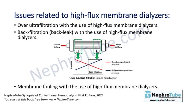 Hemodialysis: Chapter 5, Dialyzers Overview - Dr.Gawad | PDF ...